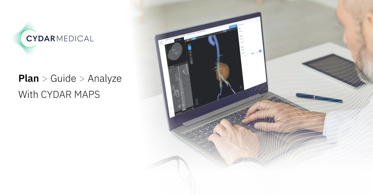 Plan | Transforming Minimally Invasive Image Guided Surgery | Cydar Medical