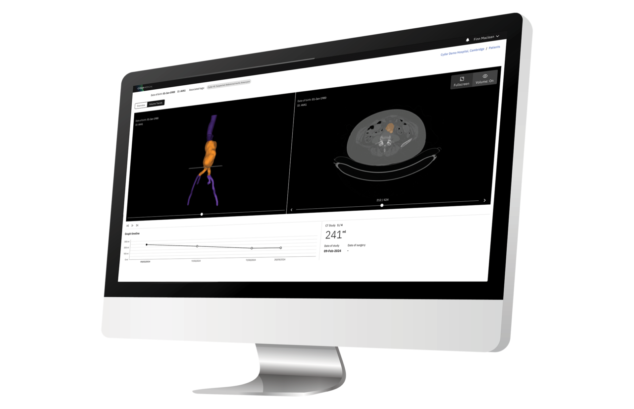 Transforming Minimally Invasive Image Guided Surgery | Cydar Medical